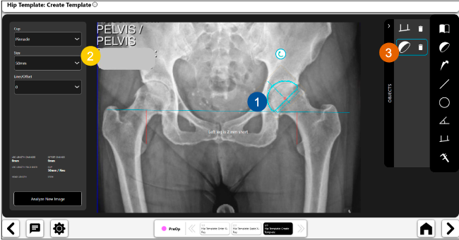 Médica Sur: Navegador Velys Hip